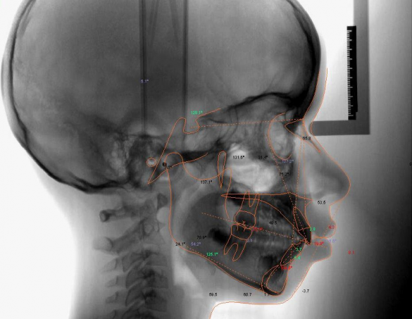 cefalometria – Ortodontia Mazzieiro Blog